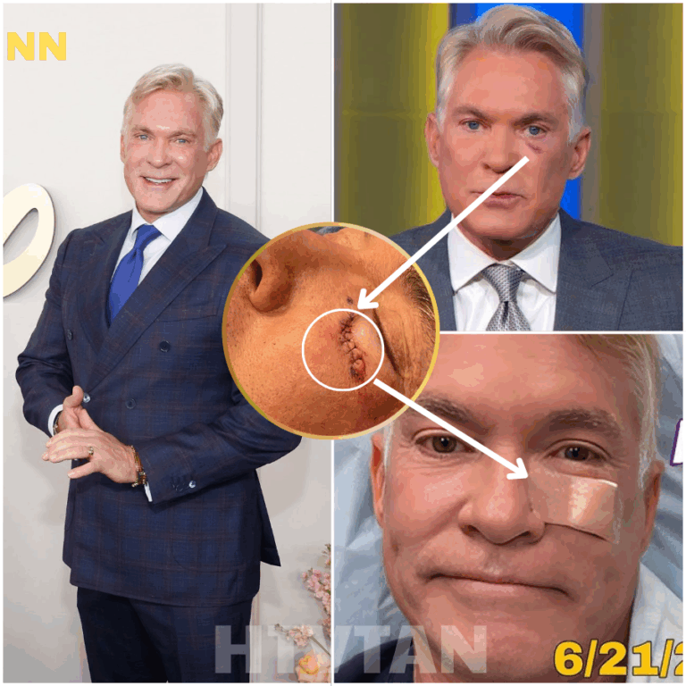 “I’M NOT OKAY, BUT DON’T WORRY”—Sam Champion’s Emotional Update on Skin ...